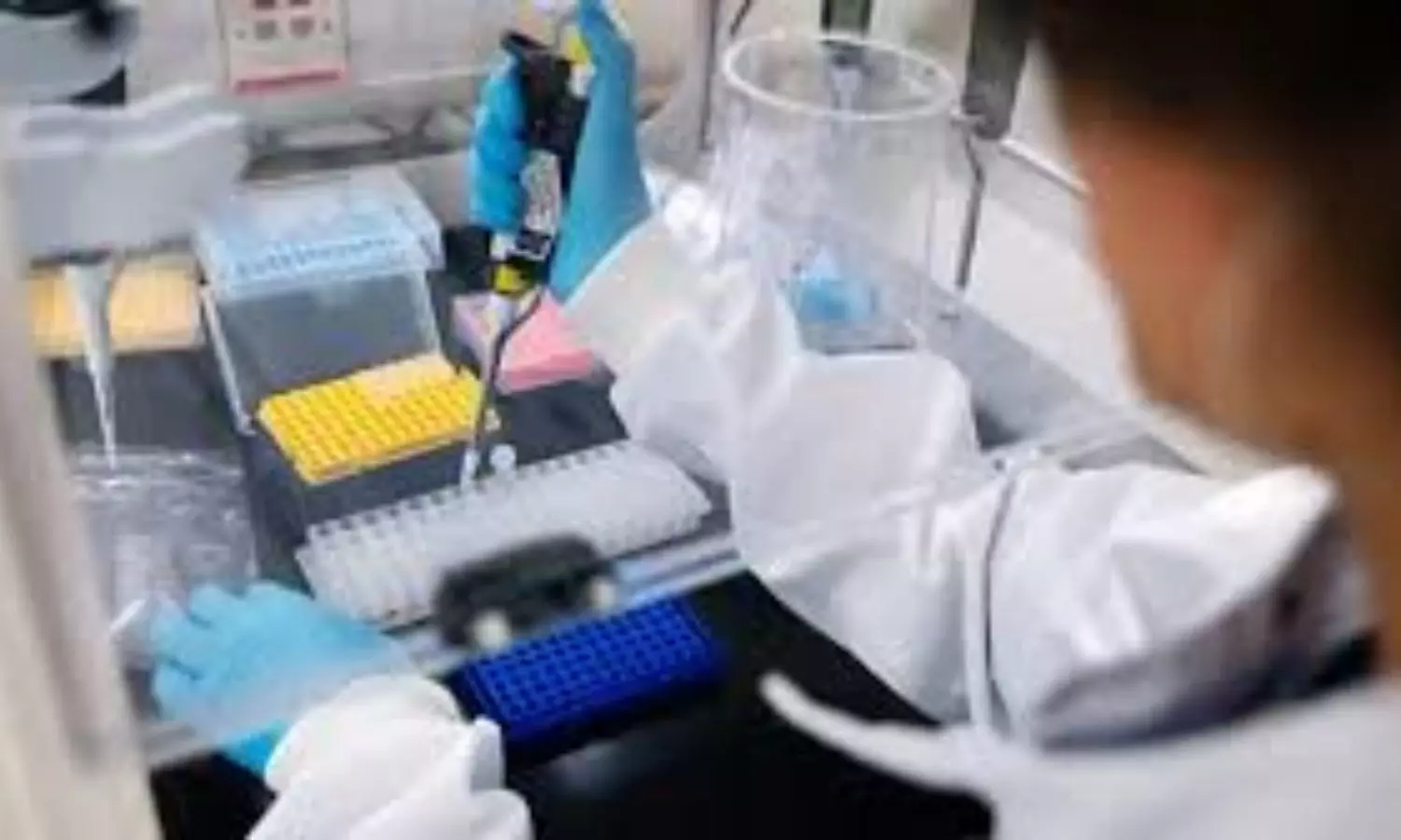 Researchers discover biological evidence to bolster autism care